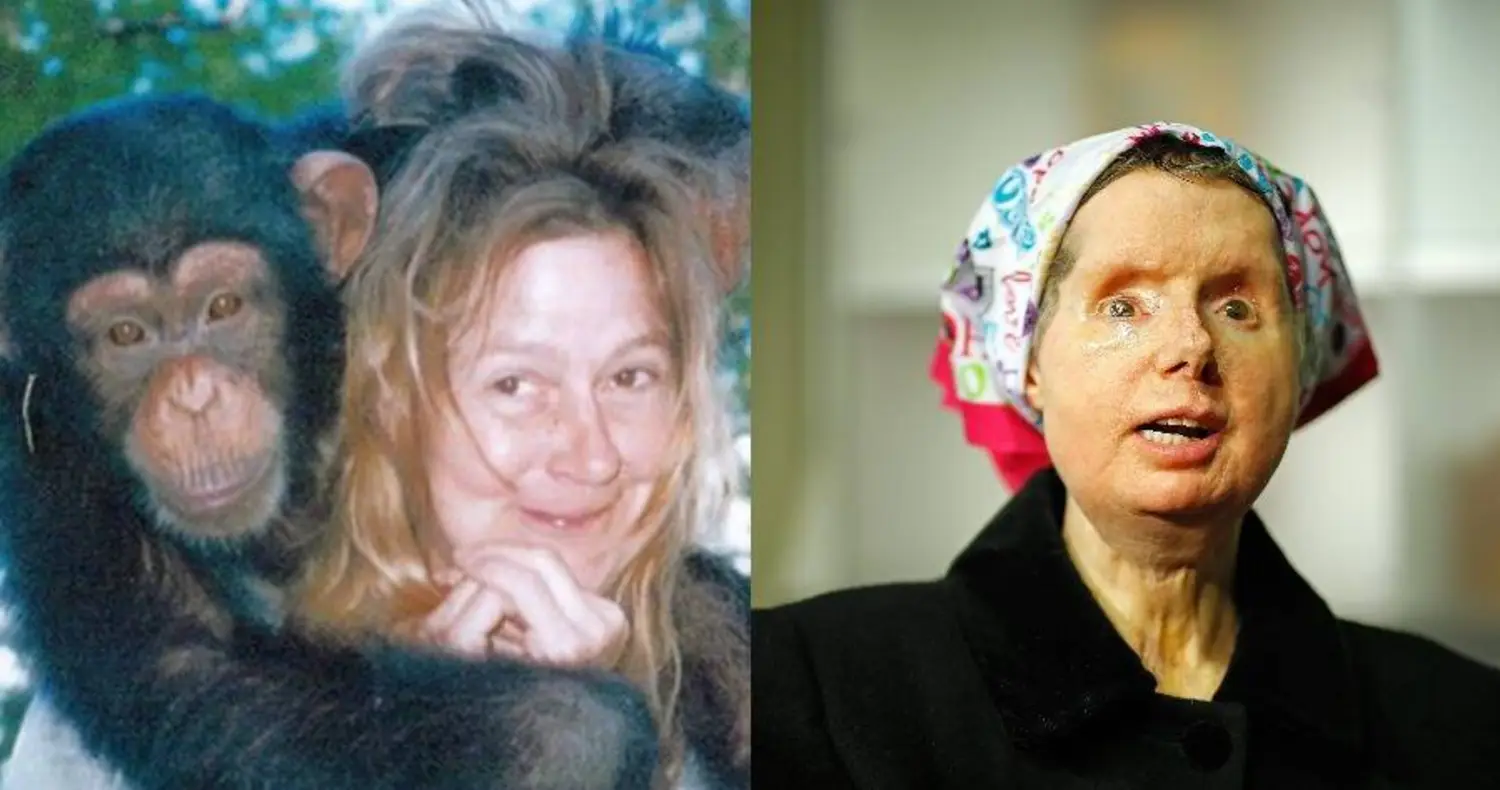 Woman Attacked By Chimpanzee