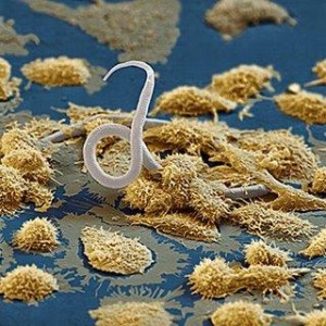 5 Terrible, Scary, Brilliant And Weird Parasites