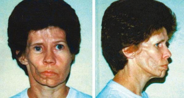 The Most Interesting Diseases To Have Ravaged Humanity