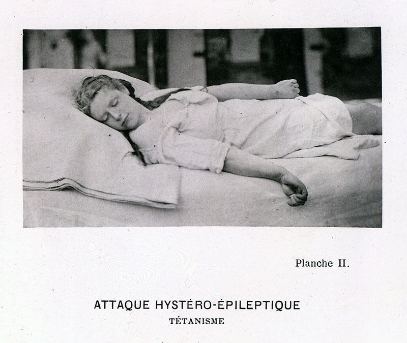 Catalepsy: Planking, Hospitals For The Dead, And "Saved By The Bell"