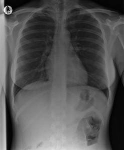 The 20 Weirdest X-Rays Known To Humankind