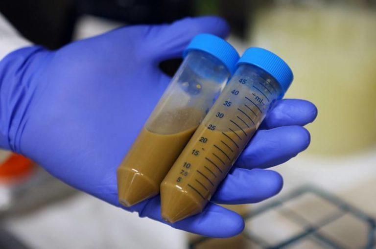 Poop Transplant: What It Is And How We Do It