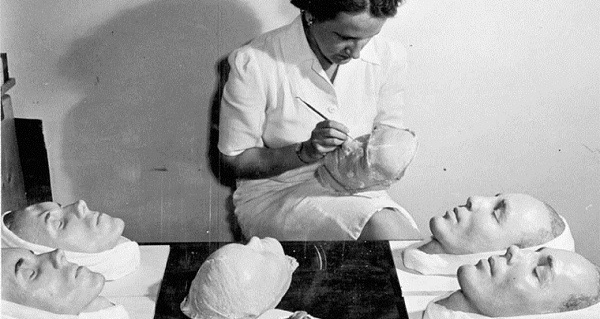 24 Before-And-After Photos From The Early Days of Plastic Surgery