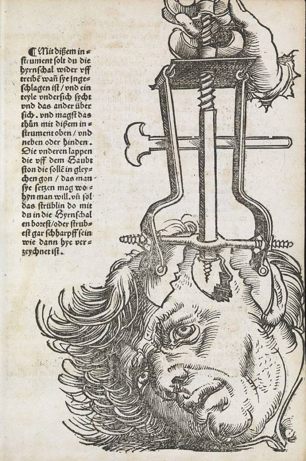Walter Freeman, The Doctor Who Popularized The Lobotomy