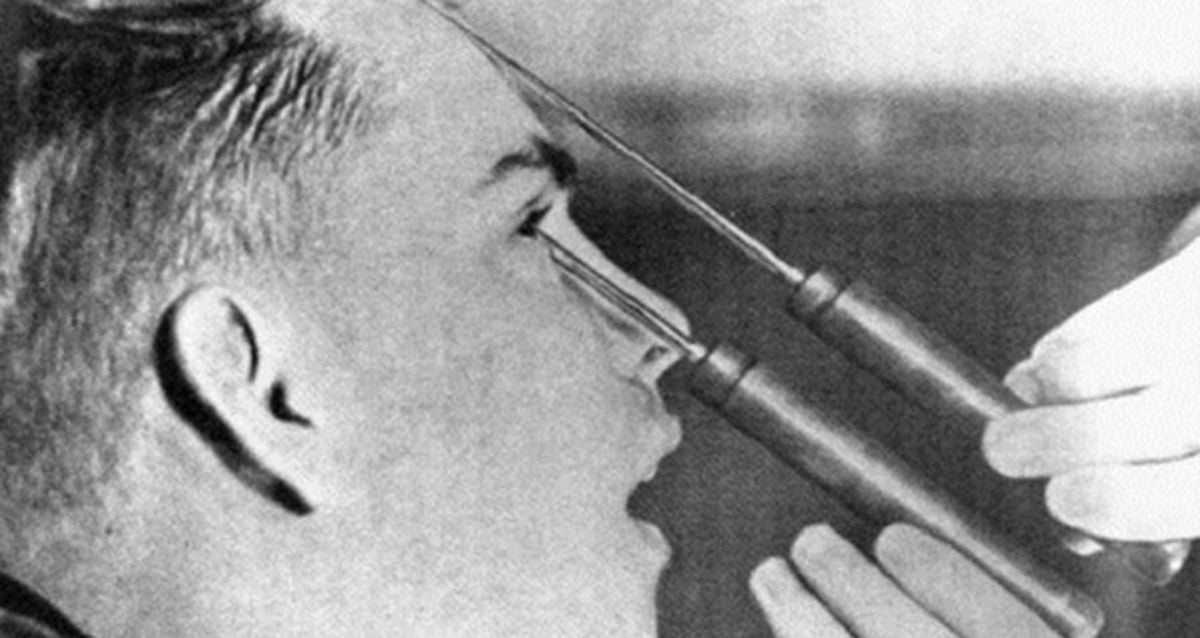 Walter Freeman, The Doctor Who Popularized The Lobotomy