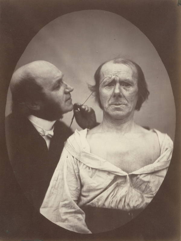 Photos Of Duchenne de Boulogne's Experiments On The Human Face