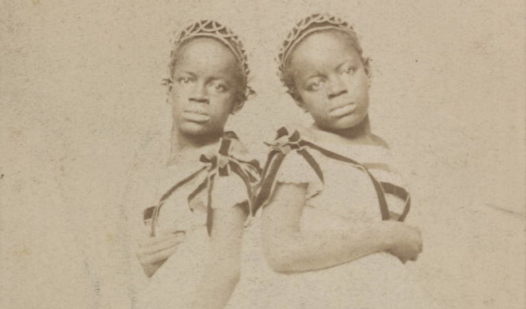How The Conjoined McCoy Twins Took Back Their Own Destiny