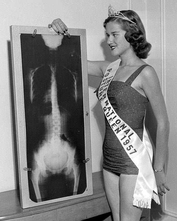 23 Creepy Photos From Historys Most Bizarre Beauty Pageants