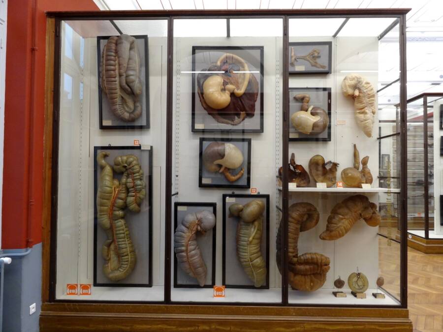 The Flayed Men And Deformities Of The Musee Fragonard