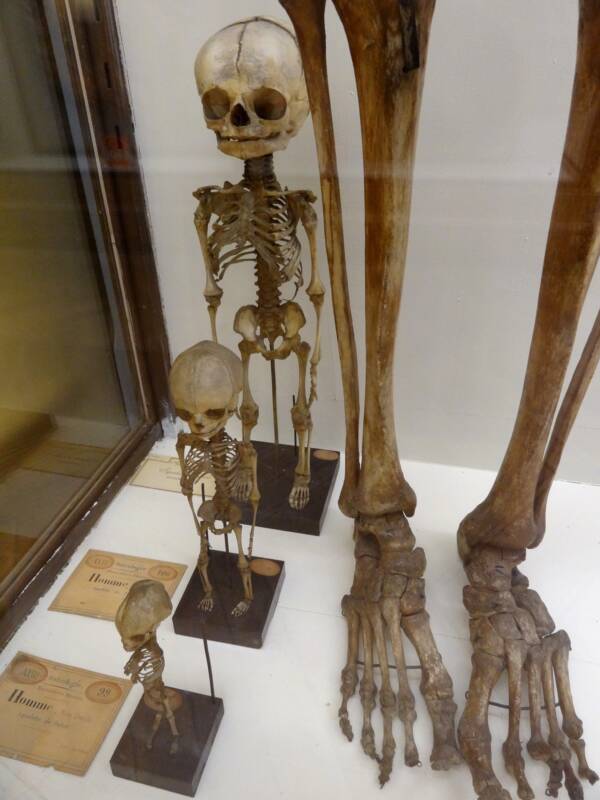 The Flayed Men And Deformities Of The Musee Fragonard