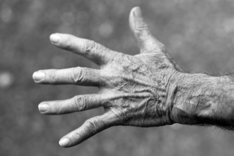 Alien Hand Syndrome: What It Is And What Might Cause It