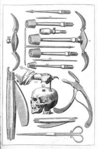 Trepanation: The Ancient Surgery Of Drilling A Hole Into The Skull