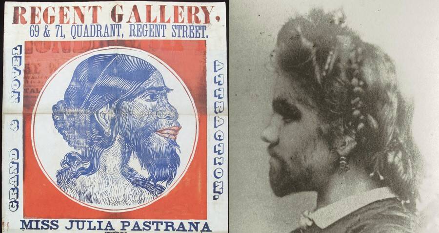 The Tragic Life of Julia Pastrana, Known As The "Baboon Woman"