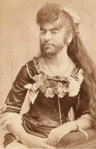 The Sad Story Of Annie Jones, P.T. Barnum's Bearded Lady