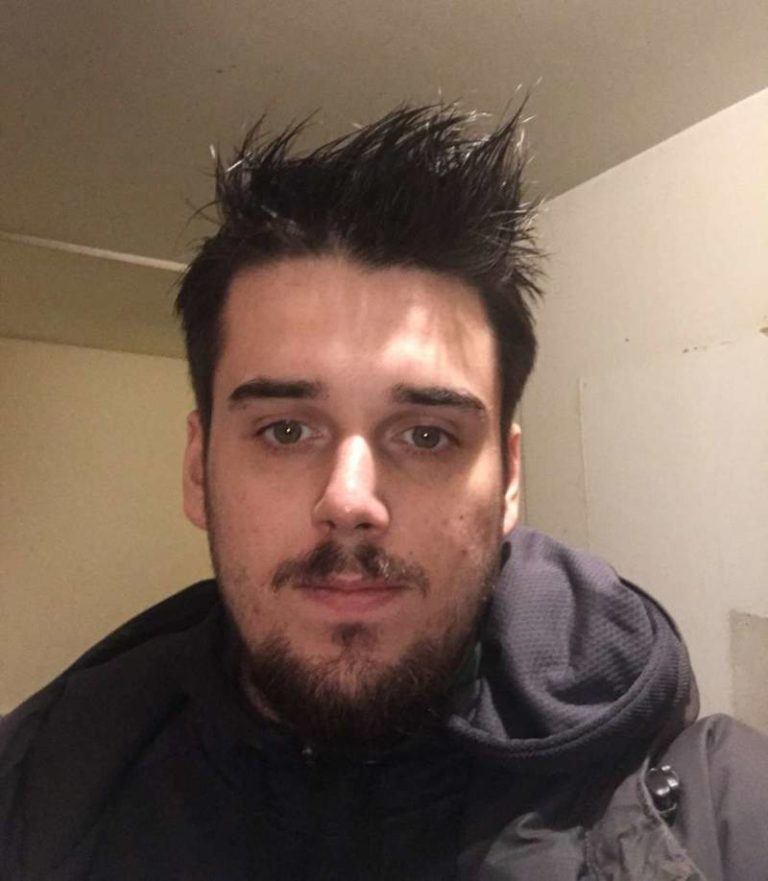 Face Transplant Gives Cameron Underwood New Lease On Life