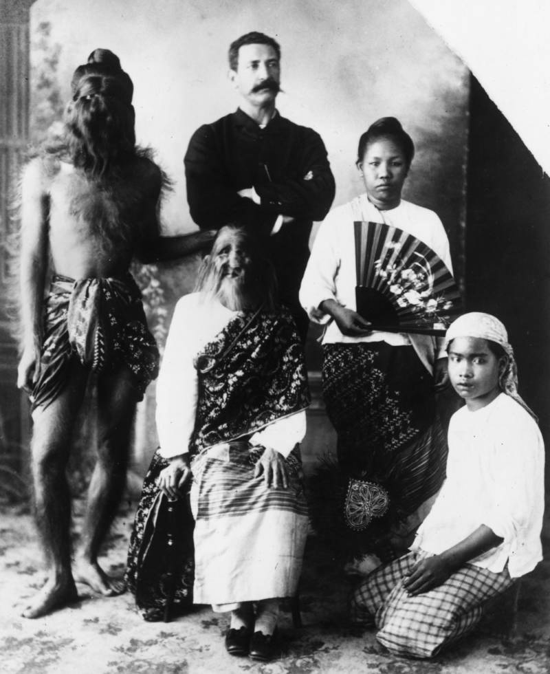 Sideshow "Freaks": 44 Disturbing Photos From Decades Past