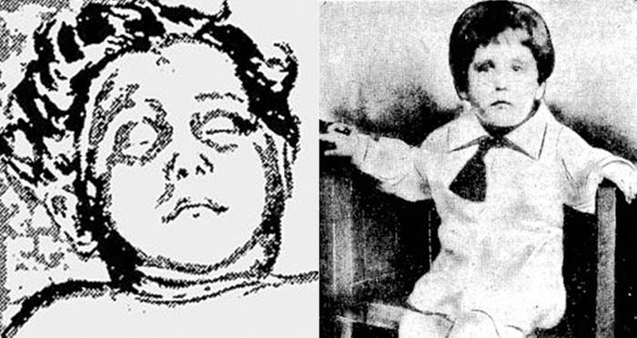Little Lord Fauntleroy: The Mysterious Body Found In A Waukesha Quarry