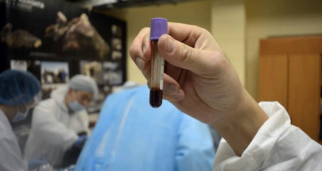 Scientists Extract Liquid Blood From 42,000-Year-Old Siberian Foal