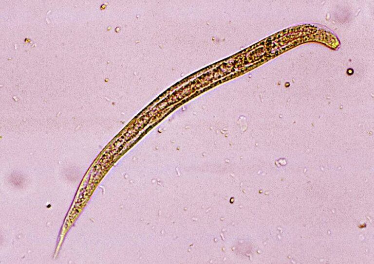 Nematodes: The Tiny Creatures That Rule The Earth