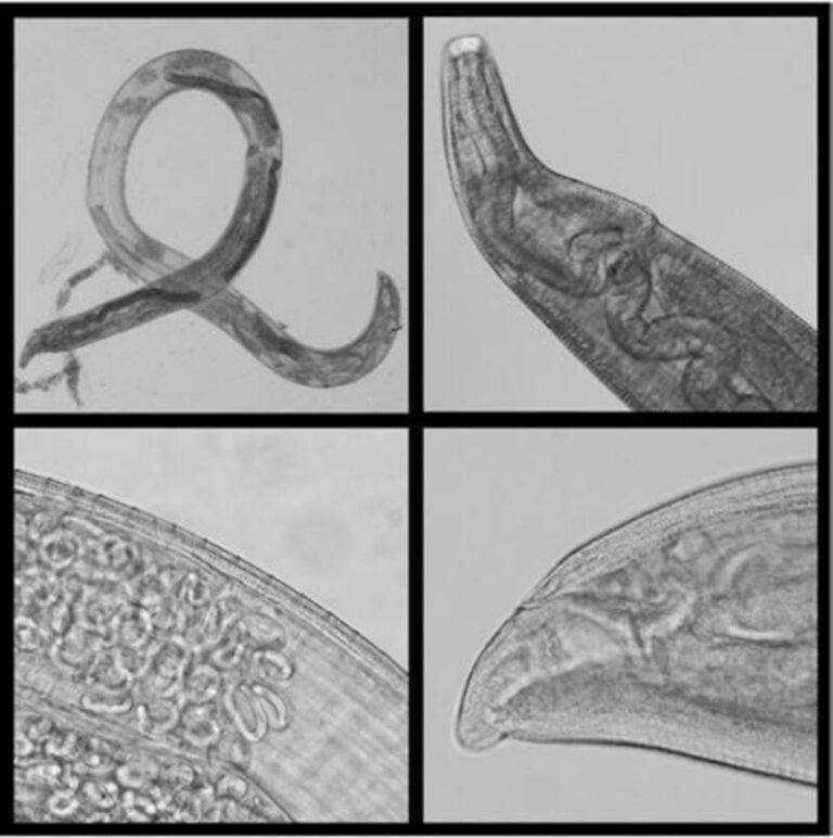 A Woman Found Parasitic Worms In Her Eye — And They Were Breeding