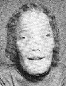 Rocky Dennis: The True Story Of The Boy Who Inspired 'Mask'