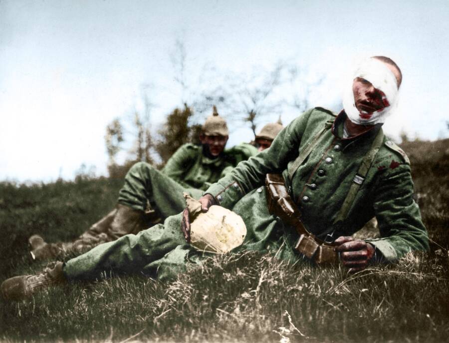 32 Colorized Images That Reveal The Horrors Of World War 1