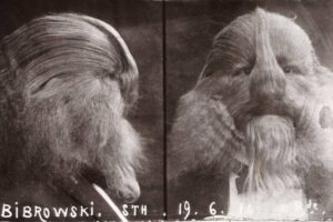 Stephan Bibrowski, A Sideshow Performer Known As The 'Lion-Faced Man'