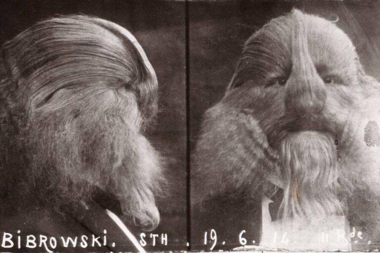 Stephan Bibrowski, A Sideshow Performer Known As The 'Lion-Faced Man'