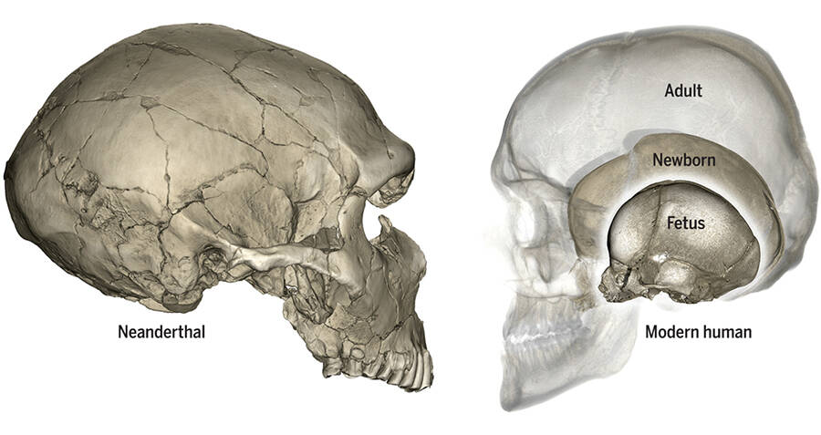 Scientists Grow Human-Neanderthal "Minibrains" In Petri Dishes