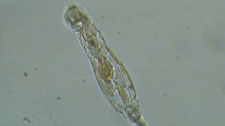 Frozen In Siberia For 24,000 Years — Microscopic Creatures Found Alive