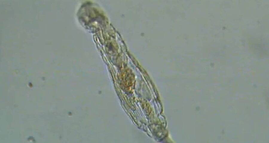 Frozen In Siberia For 24,000 Years — Microscopic Creatures Found Alive