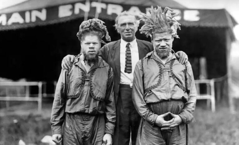 George And Willie Muse, The Brothers Kidnapped By The Circus