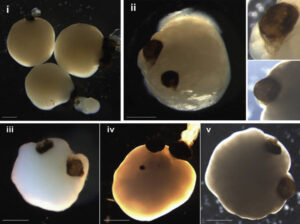 Tiny Lab-Grown Brains Sprout Functional Human Eyes