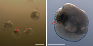 Tiny Lab-Grown Brains Sprout Functional Human Eyes