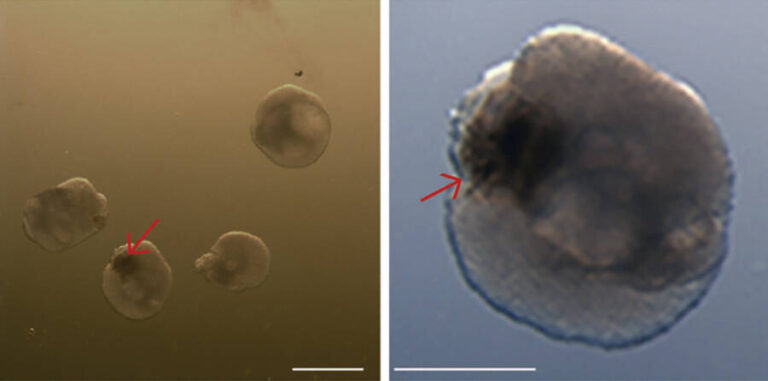 Tiny Lab-Grown Brains Sprout Functional Human Eyes
