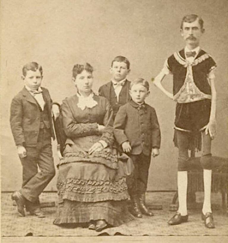 Isaac W. Sprague, The Living Skeleton Of Sideshow Fame