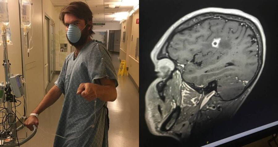 Tyson Bottenus: Grad Student Contracts Rare Brain Fungus