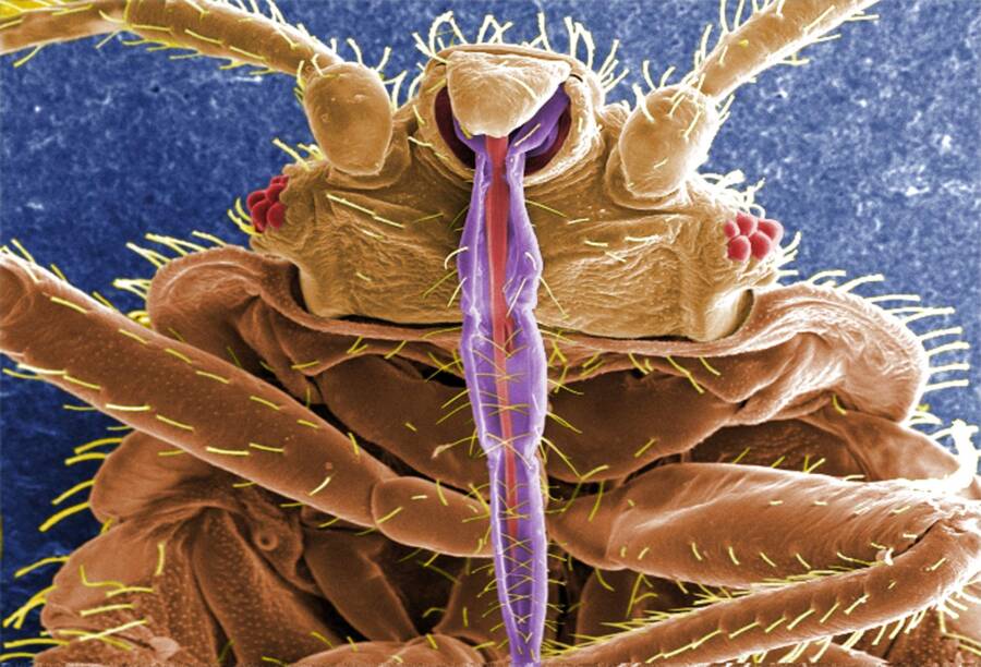 44 Electron Microscope Images That Bring The Invisible To Life