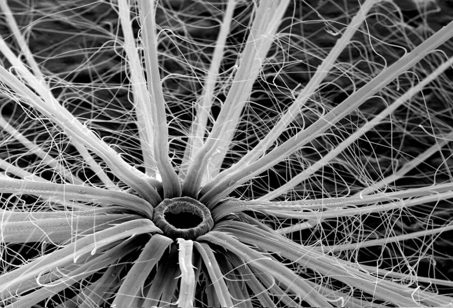 44 Electron Microscope Images That Bring The Invisible To Life