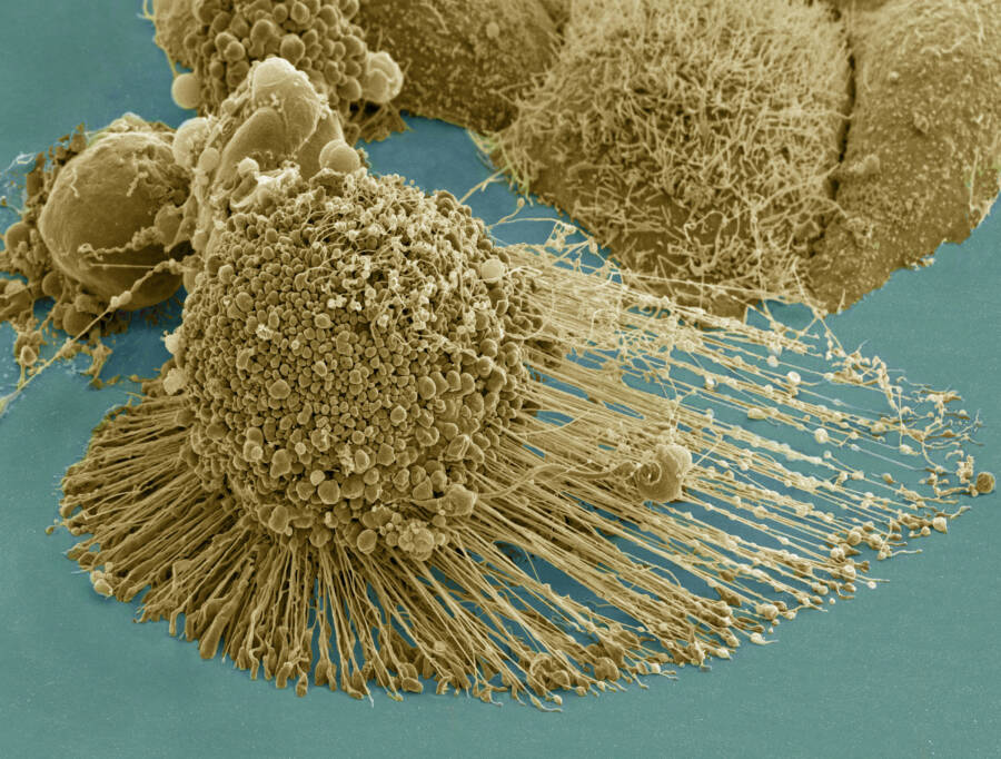 44 Electron Microscope Images That Bring The Invisible To Life