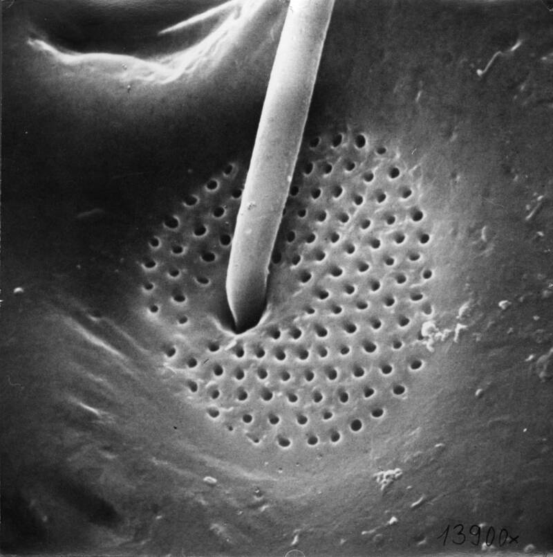 44 Electron Microscope Images That Bring The Invisible To Life