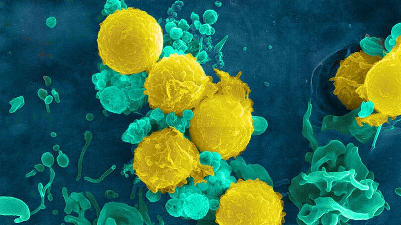 44 Electron Microscope Images That Bring The Invisible To Life