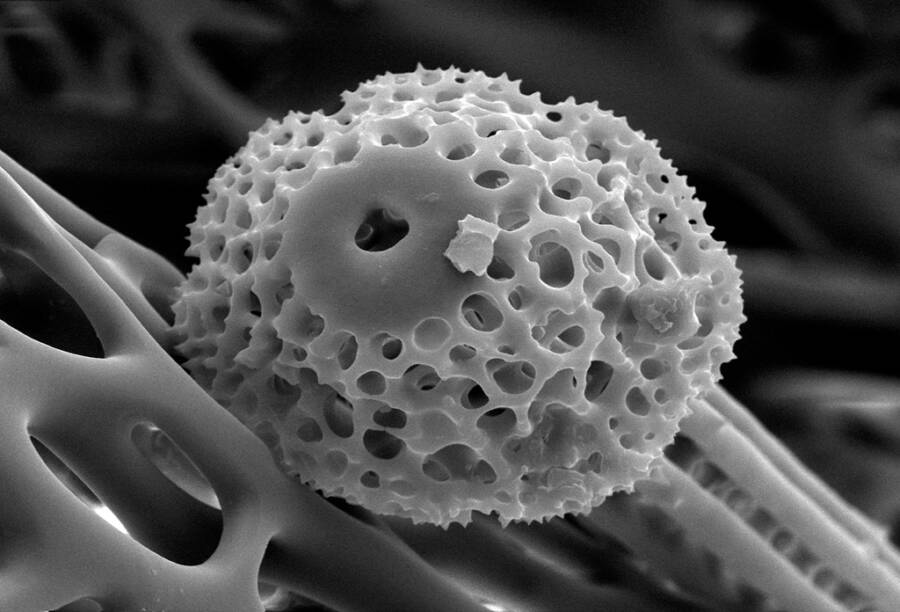 44 Electron Microscope Images That Bring The Invisible To Life