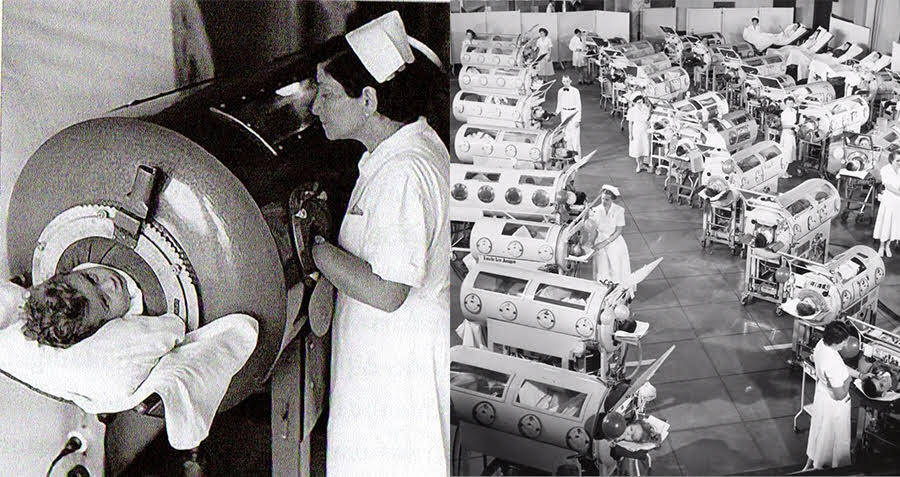 Inside America's Polio Epidemics In 44 Unsettling Photos