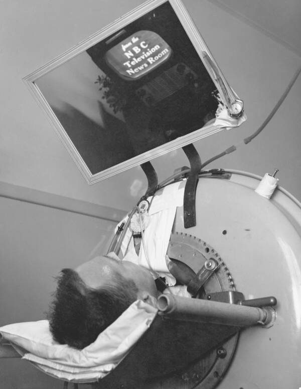 Inside America's Polio Epidemics In 44 Unsettling Photos