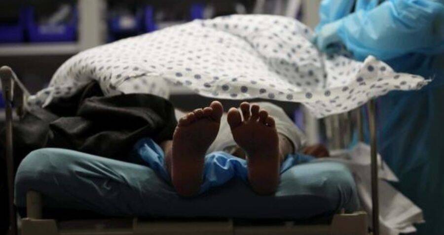 Nurse Amputates Man's Foot To Display It In A Taxidermy Shop