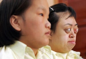 The Brutal History Of Agent Orange And Its Tragic Victims