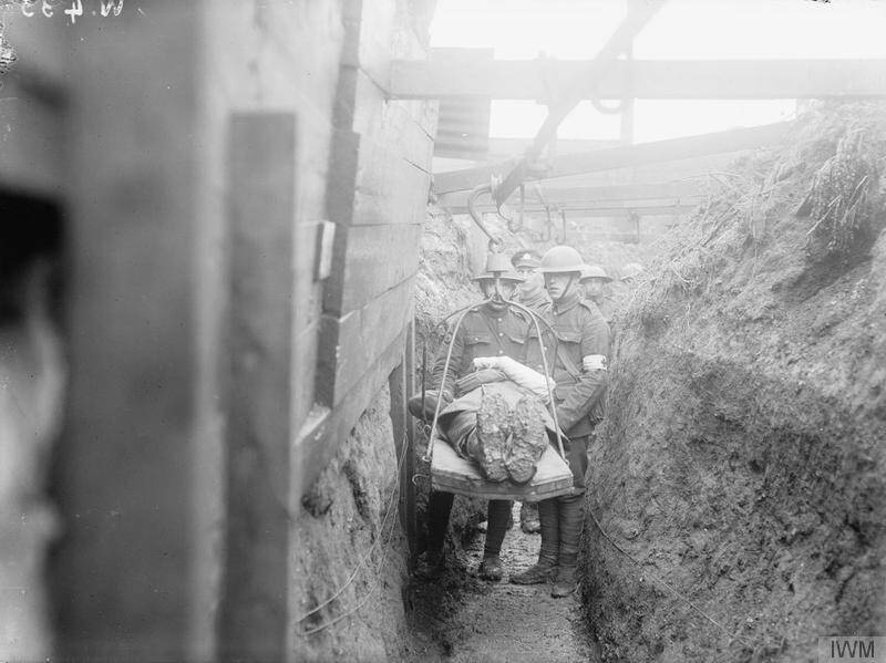 WW1 Trenches: 55 Photos That Reveal Life In Trench Warfare
