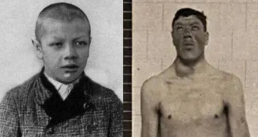 Adam Rainer, The Man Who Grew From A Dwarf To A Giant