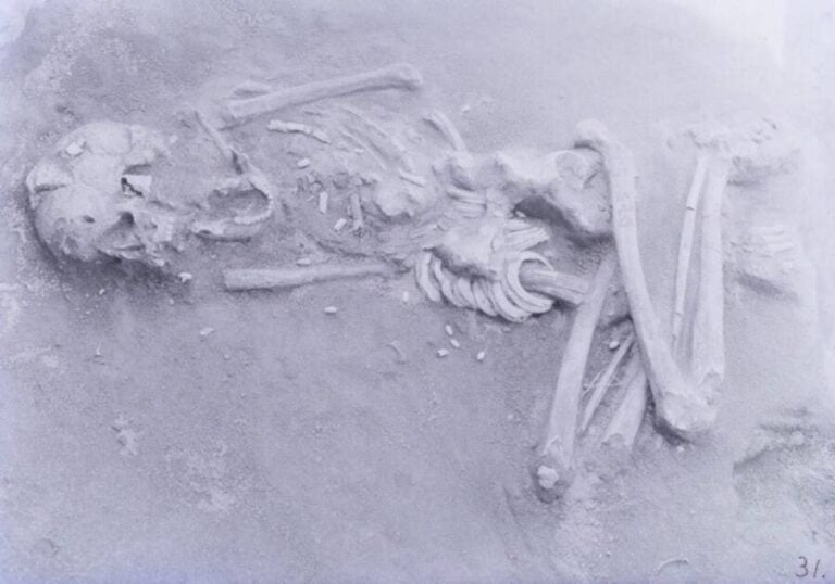 Did The Hirota People Of Japan Intentionally Deform Their Skulls?